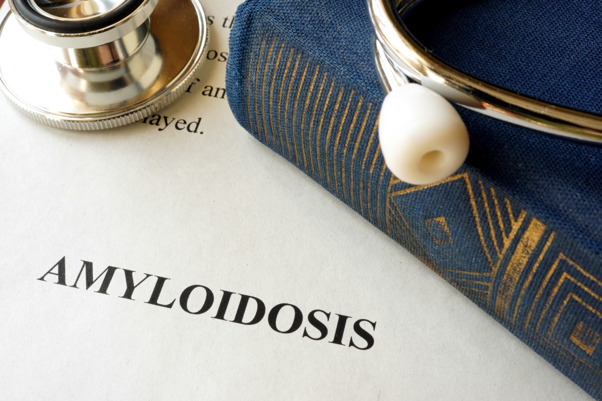 Amiloidosis: ¿qué es y por qué surge, qué síntomas presenta ...